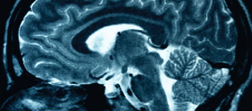 Neuroscience Graduate Program | College of Natural & Agricultural Sciences